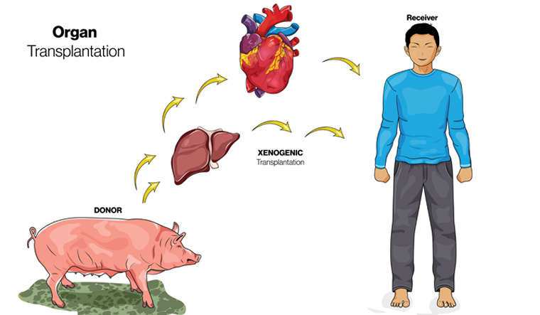 Making pig livers humanlike in quest to ease organ shortage- The Week