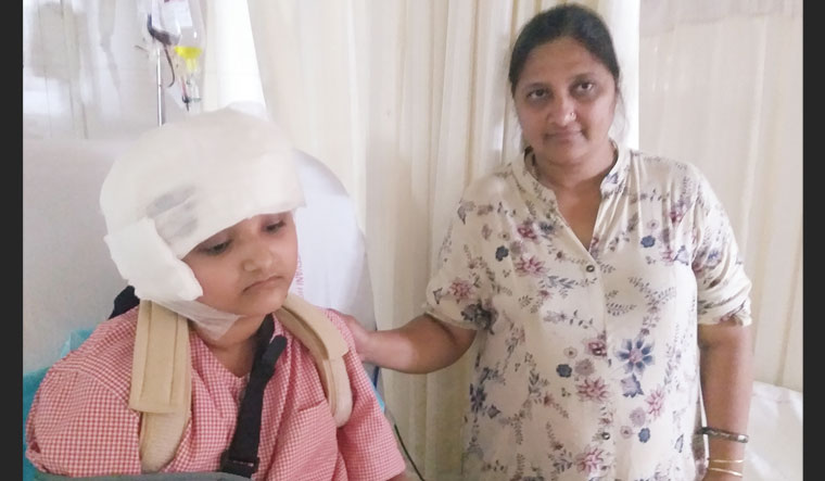Girl loses half her hair in go-carting mishap at Mahabaleshwar- The Week