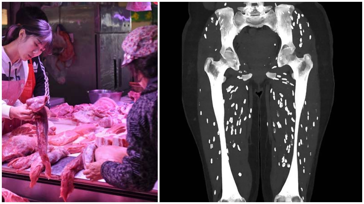 Cook pork properly if you don't want parasites to do this to your body ...