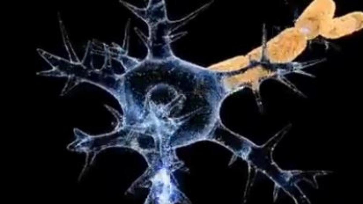 Guillain-Barre Syndrome (GBS): What do we know so far?- The Week