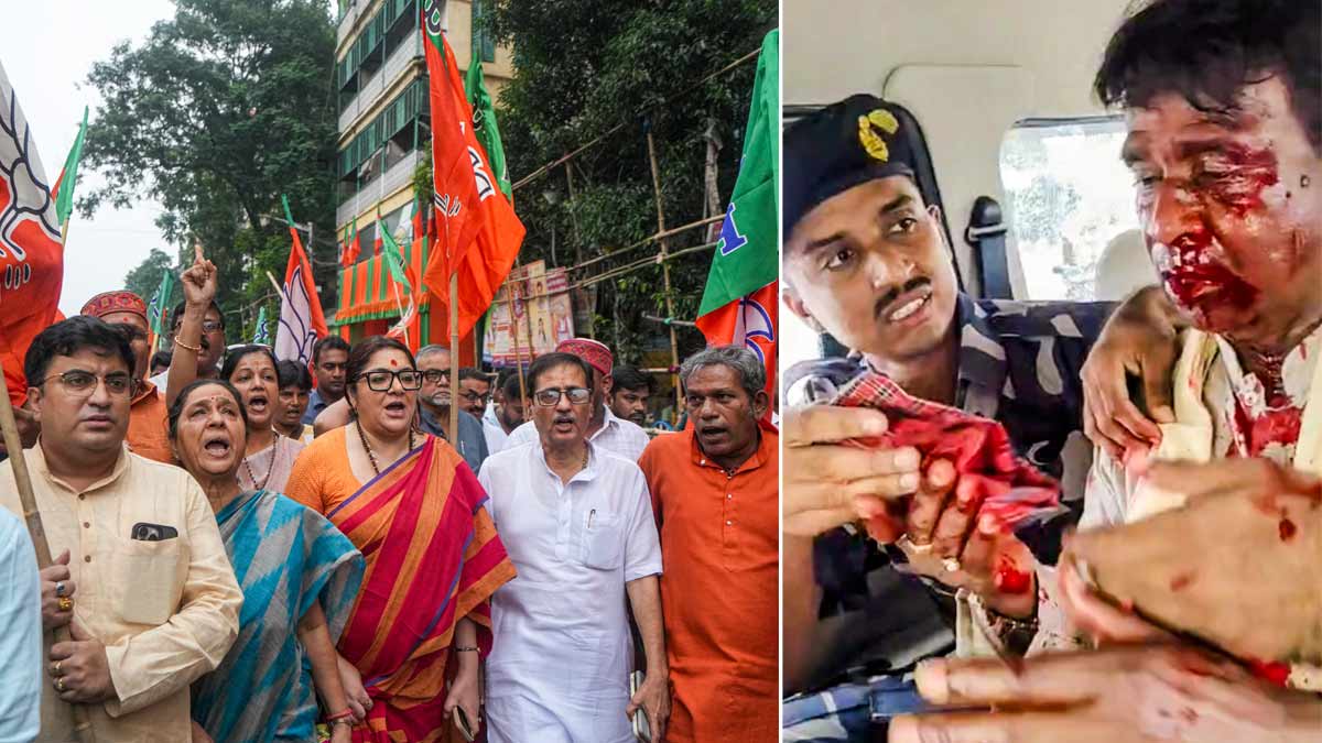 BJP MP Murmu, still in ICU, may require surgery; no arrest yet in ...